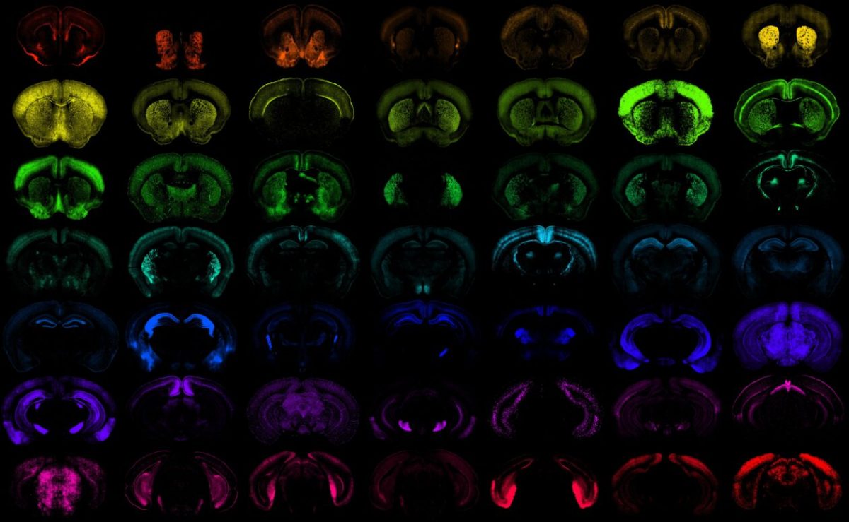Allen Institute unveils brain research tool that promises 'aha moments ...